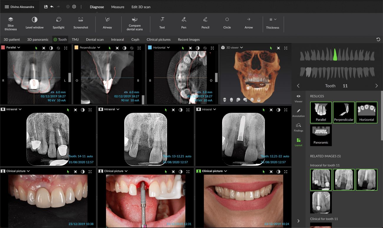 DTX Studio reformula medicina dentária | LabPro